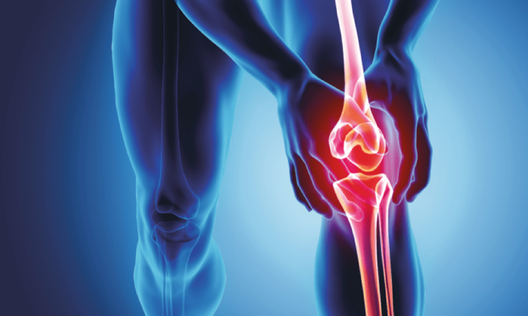 Bone and Joint Diseases We Should Learn About - List Absolute